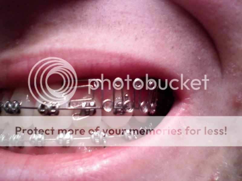 New to the forums! - Metal Mouth Message Board